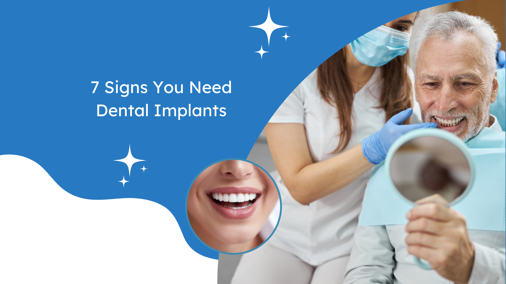 5 Signs You Need Dental Implants